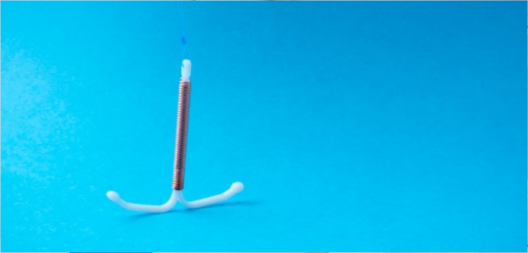 Mirena IUS - Cardiff Gynaecology Clinic